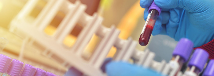 Doenças Genéticas - Deficiencia del factor XII | Genera